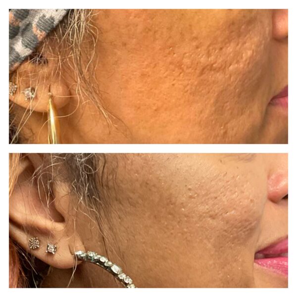 Skin Remodeling in Brecksville | Radiant Divine Medical Spa